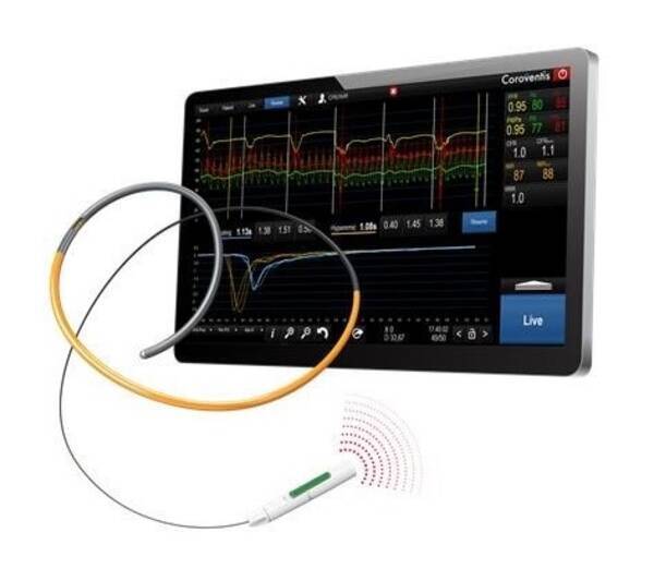アボット、包括的に冠動脈疾患の評価を支援する血行動態測定医療機器プログラム「CoroFlow(TM)カーディオバスキュラー システム」の製造 ...